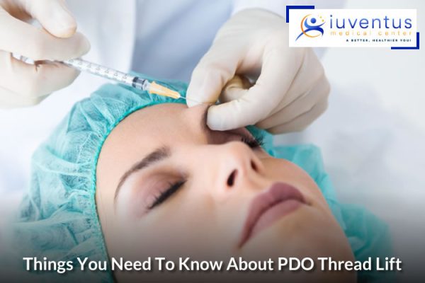 Things You Need To Know About PDO Thread Lift - Iuventus Medical Center