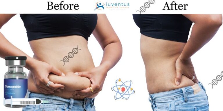 The Science Behind Semaglutide and Weight Loss: What You Need to Know