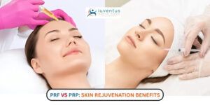PRF vs. PRP: Key Differences and Benefits for Skin Rejuvenation